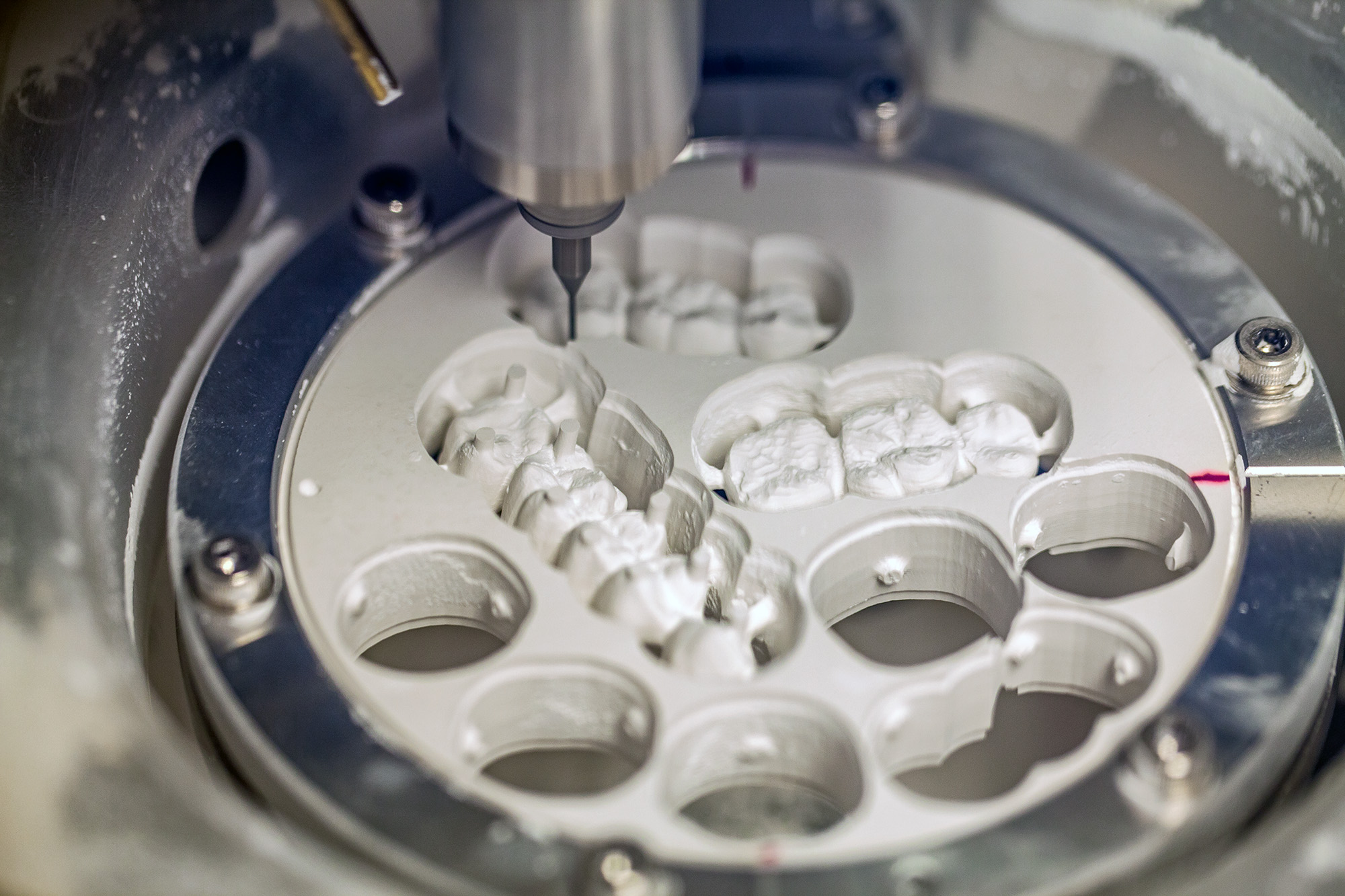 What is a Dental Milling Machine? Basic Knowledge and Challenges ...